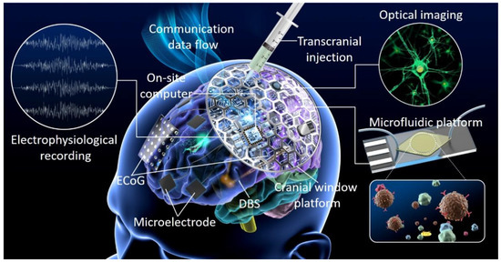 From Transparent Cranial Windows to Multifunctional Smart Cranial Platforms