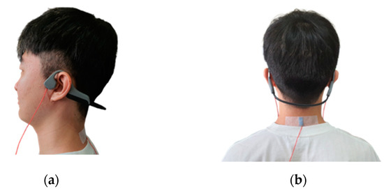 Electronics | Free Full-Text | Development of an Electrooculogram (EOG) and Surface ...