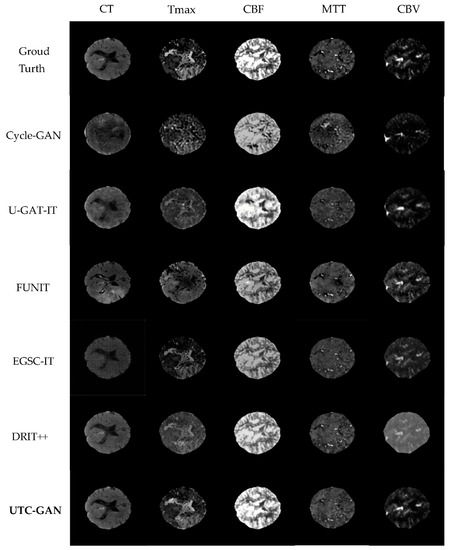 Multimodal CT Image Synthesis Using Unsupervised Deep Generative Adversarial Networks for Stroke ...