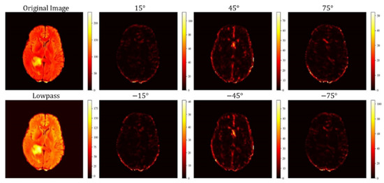 LSW-Net: A Learning Scattering Wavelet Network for Brain Tumor and ...