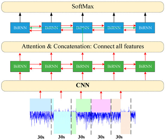 Deep Learning Model of Sleep EEG Signal by Using Bidirectional ...