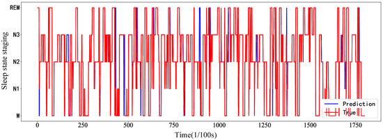 Deep Learning Model of Sleep EEG Signal by Using Bidirectional ...