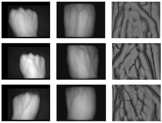 Electronics | Free Full-Text | Recognition of Dorsal Hand Vein in Small-Scale Sample Database ...