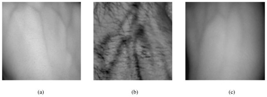 Recognition of Dorsal Hand Vein in Small-Scale Sample Database Based on ...
