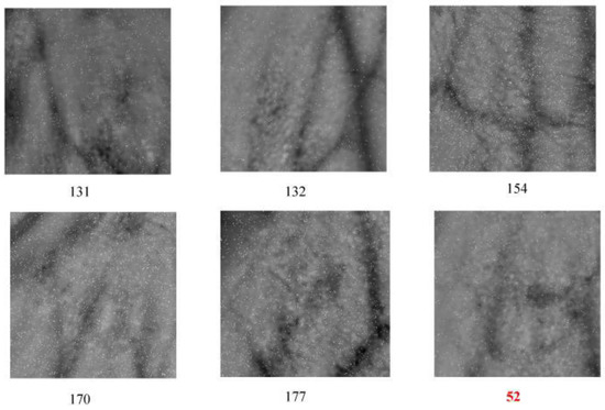 Recognition of Dorsal Hand Vein in Small-Scale Sample Database Based on ...