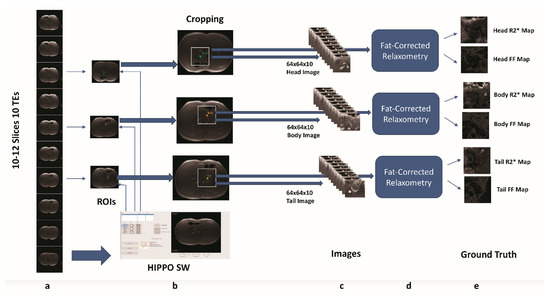 Fat-Corrected Pancreatic R2* Relaxometry from Multi-Echo Gradient ...