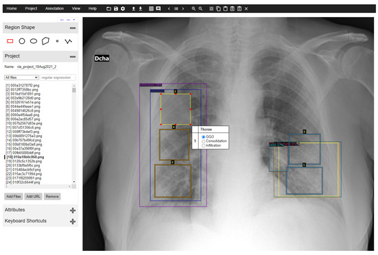 COVID-19-Associated Lung Lesion Detection by Annotating Medical Image ...