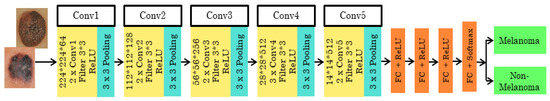 Comparative Analysis of Melanoma Classification Using Deep Learning ...