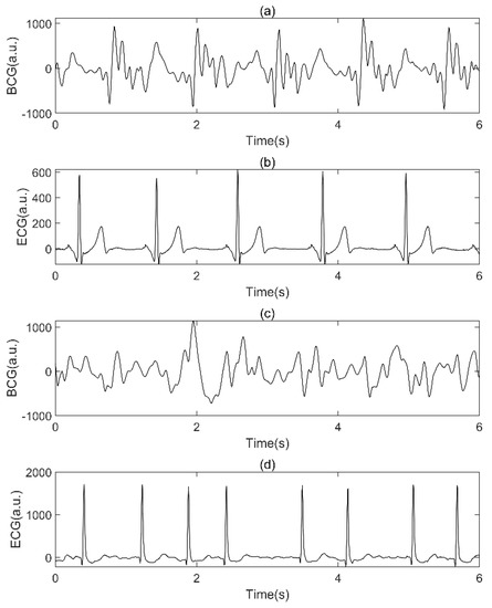 Atrial Fibrillation Detection Based on a Residual CNN Using BCG Signals