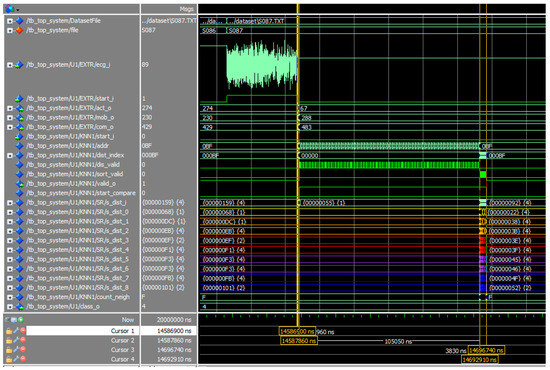 FPGA-Based Implementation for Real-Time Epileptic EEG Classification Using Hjorth Descriptor and KNN