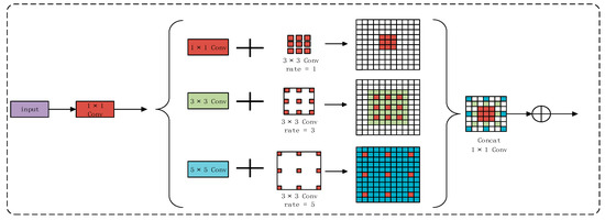 Electronics | Free Full-Text | A Novel Deep-Learning-Based Enhanced Texture Transformer Network ...