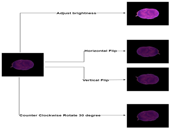 A Deep Learning-Based Approach for the Diagnosis of Acute Lymphoblastic Leukemia