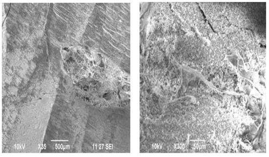 Penetration Estimation in SEM, EDAX Dental Imaging Systems for ...