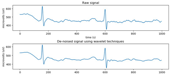 Arrhythmia Classification and Diagnosis Based on ECG Signal: A Multi ...