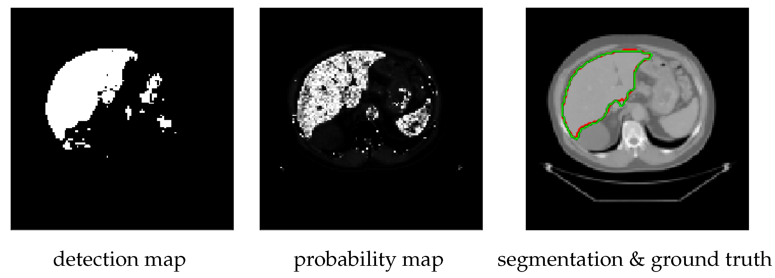 Fast 3D Liver Segmentation Using a Trained Deep Chan-Vese Model