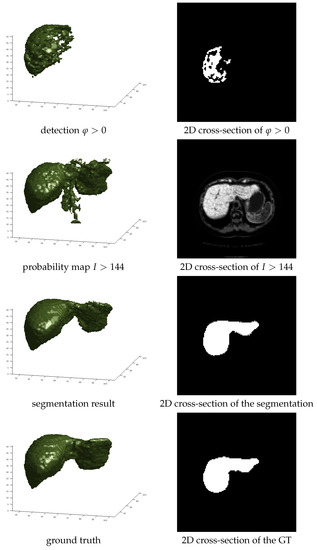 Fast 3D Liver Segmentation Using a Trained Deep Chan-Vese Model