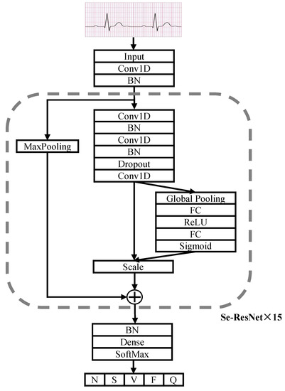 Arrhythmia Detection Based on WGAN-GP and SE-ResNet1D