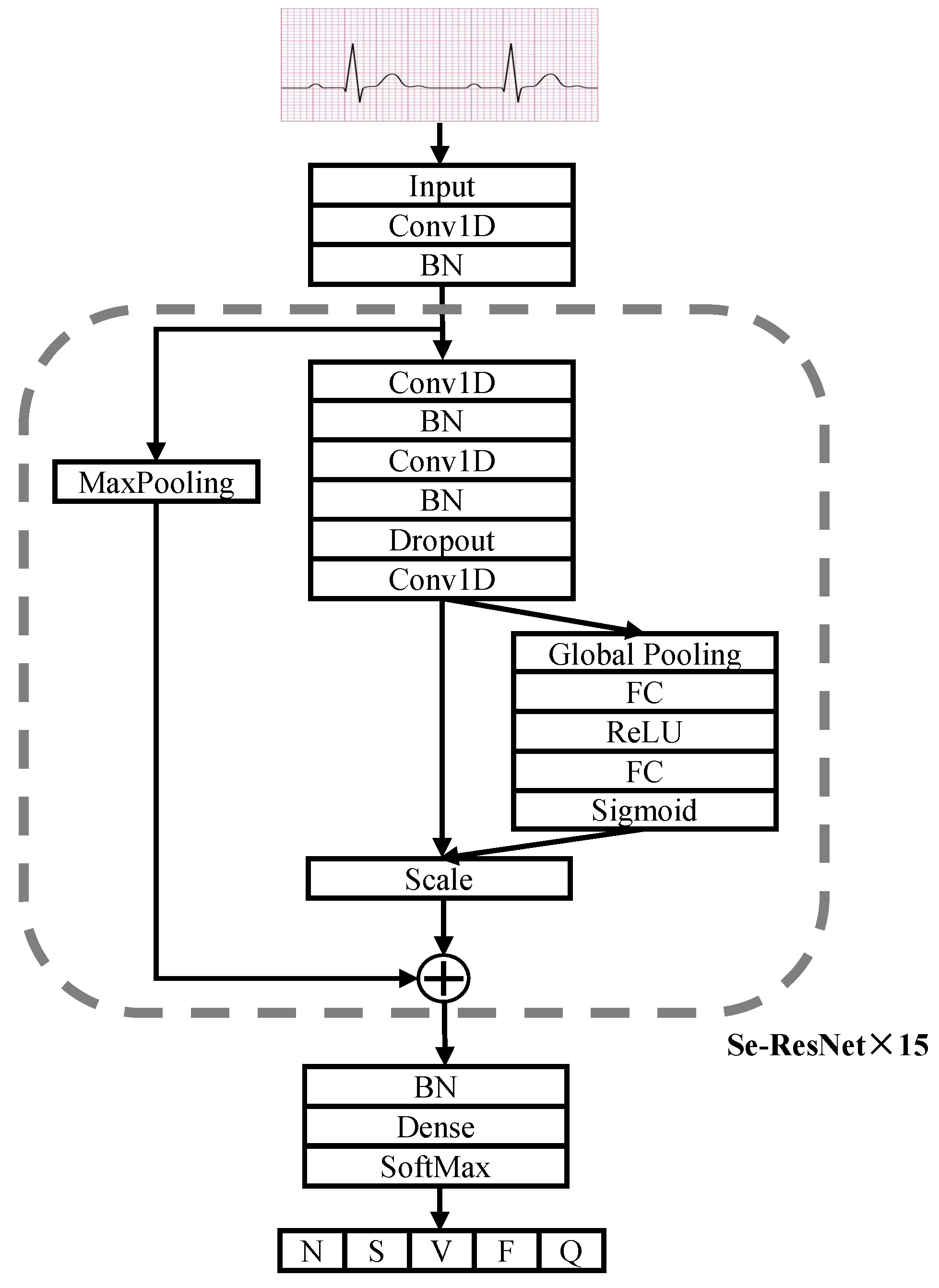 Arrhythmia Detection Based on WGAN-GP and SE-ResNet1D