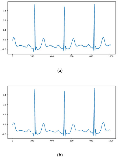 Arrhythmia Detection Based on WGAN-GP and SE-ResNet1D