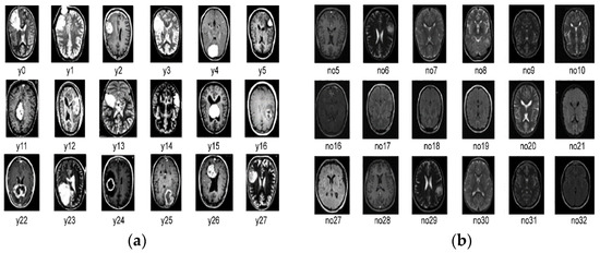 Brain Tumor Classification and Detection Using Hybrid Deep Tumor Network