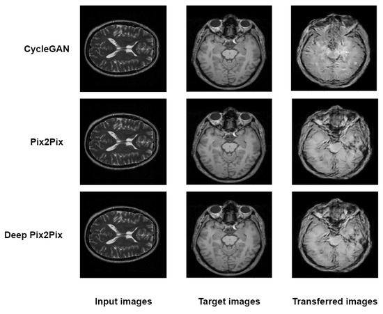 Generating Synthetic Images for Healthcare with Novel Deep Pix2Pix GAN