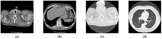 A Method Noise-Based Convolutional Neural Network Technique for CT Image Denoising