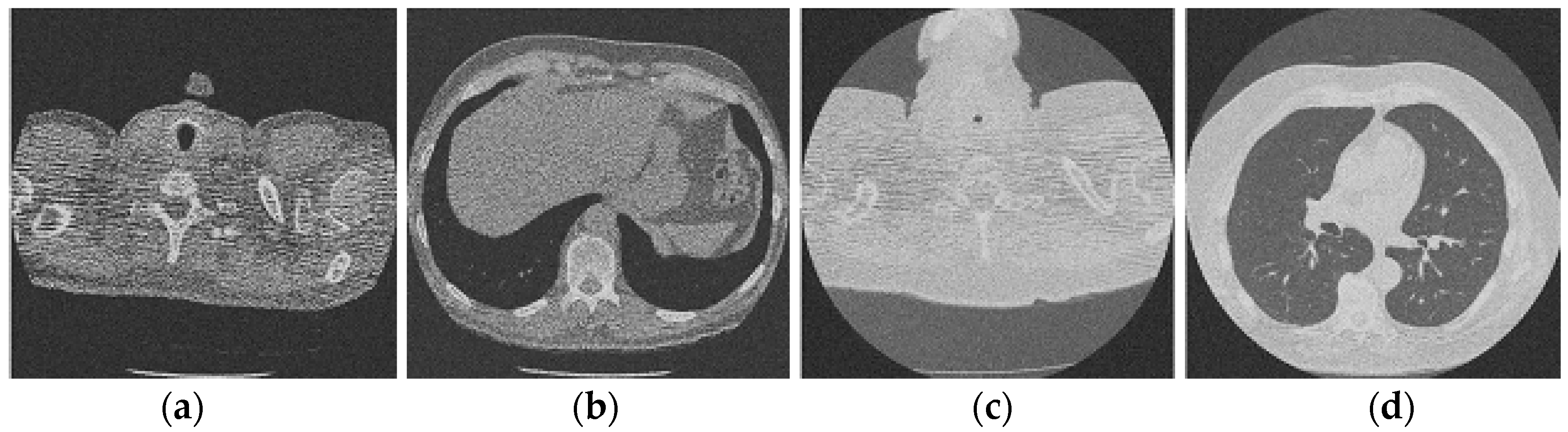 A Method Noise-Based Convolutional Neural Network Technique for CT Image Denoising