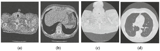 A Method Noise-Based Convolutional Neural Network Technique for CT Image Denoising