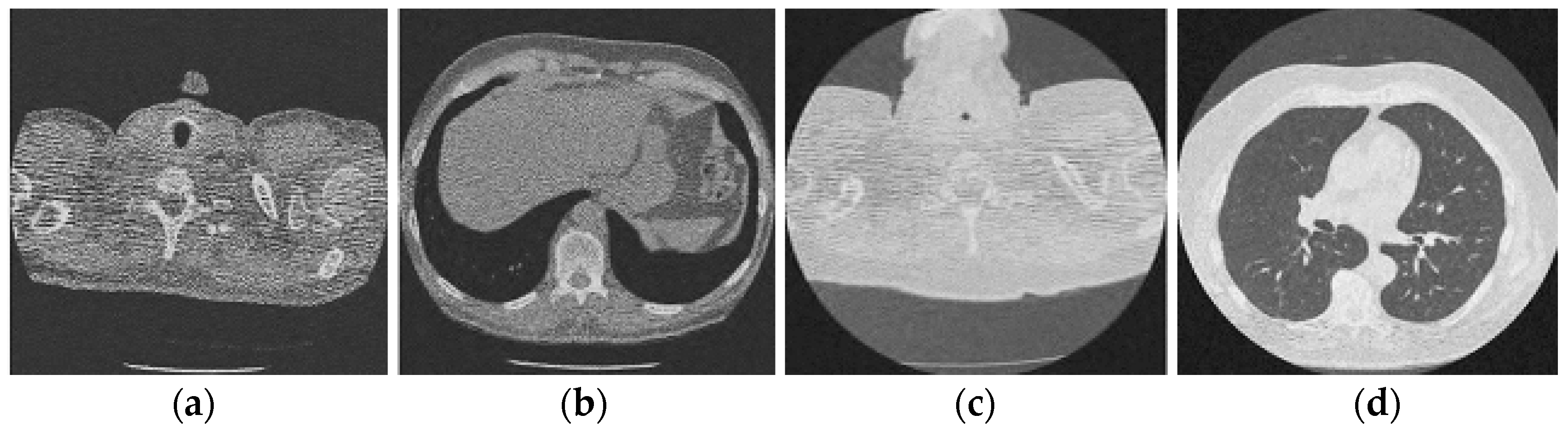 A Method Noise-Based Convolutional Neural Network Technique for CT ...