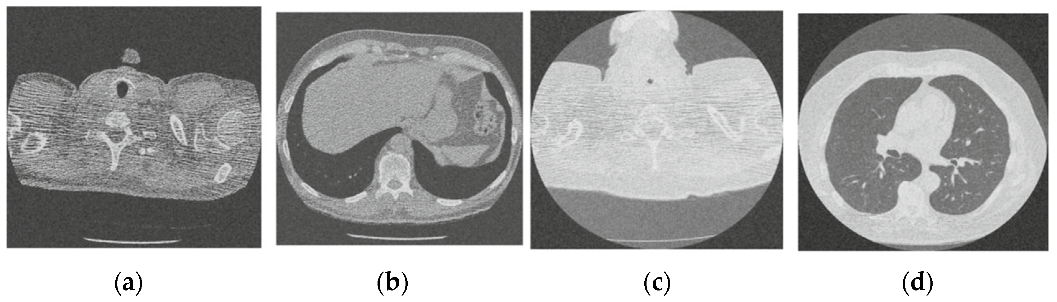 A Method Noise-Based Convolutional Neural Network Technique for CT ...