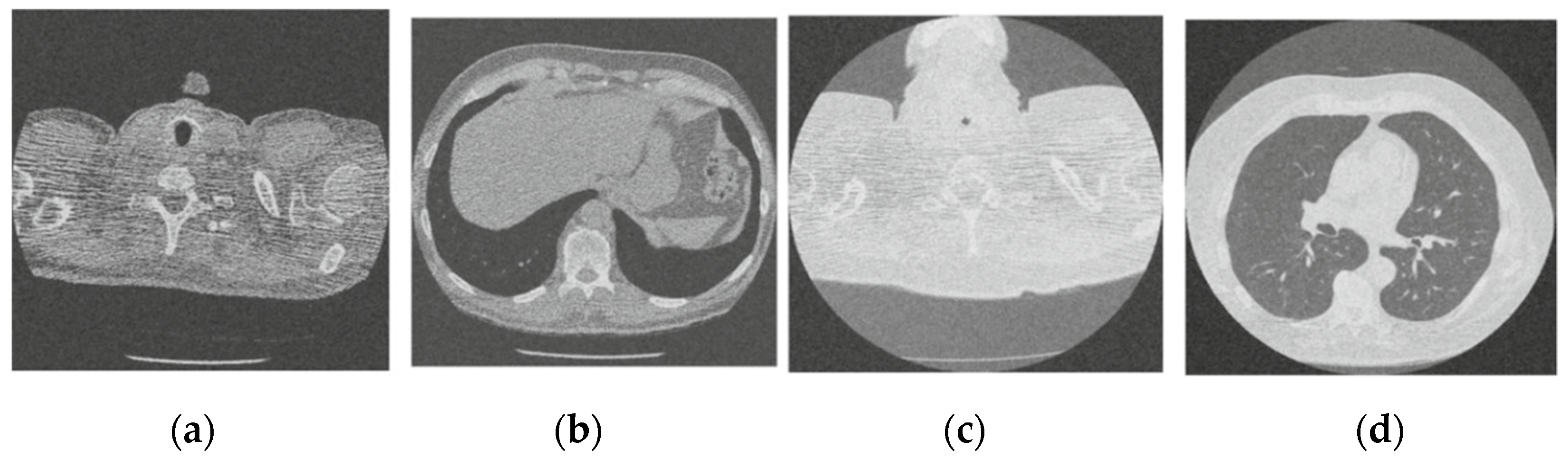A Method Noise-Based Convolutional Neural Network Technique for CT Image Denoising