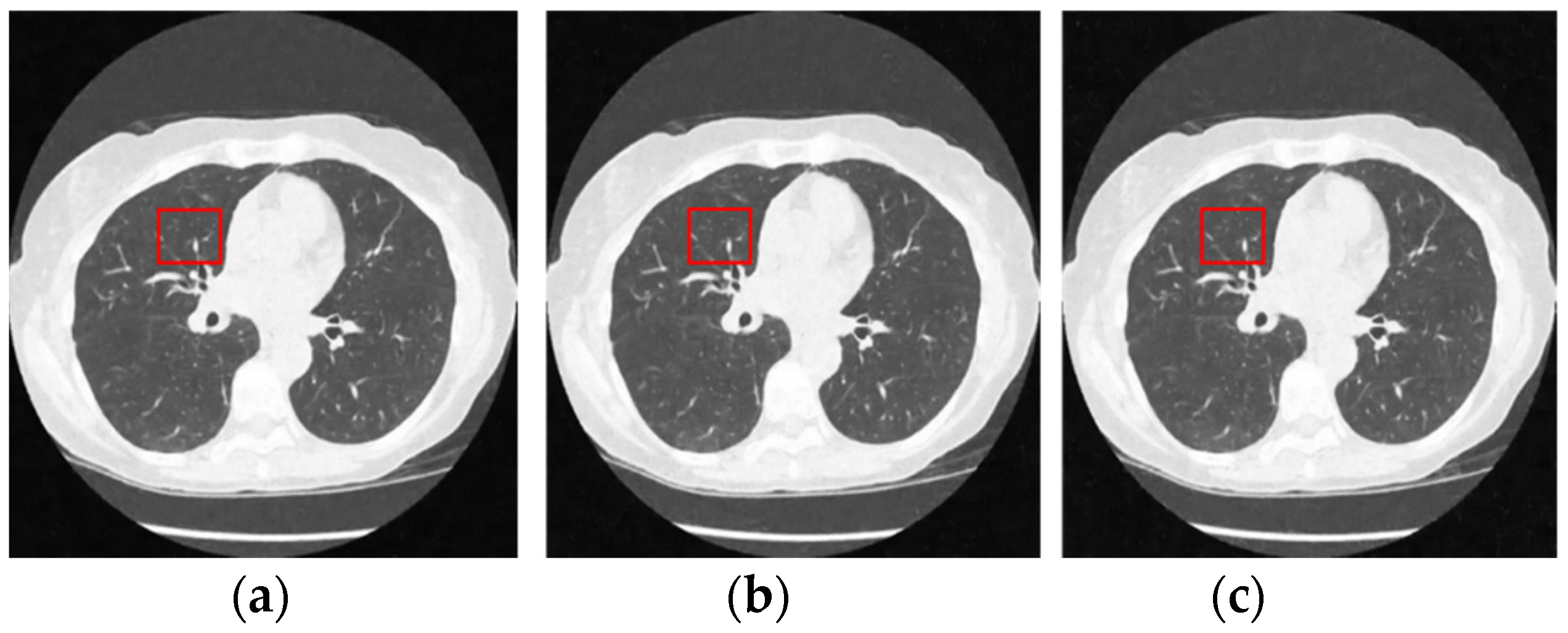 A Method Noise-Based Convolutional Neural Network Technique for CT ...