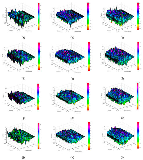 Research on Improved DenseNets Pig Cough Sound Recognition Model Based on SENets