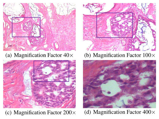 A Federated Learning Framework for Breast Cancer Histopathological Image Classification