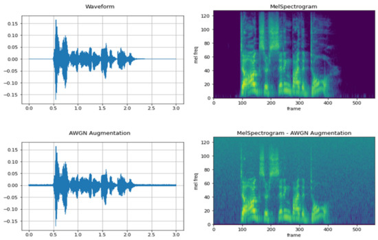 Speech Emotion Recognition Based on Parallel CNN-Attention Networks ...
