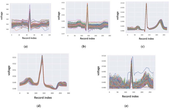 A Novel Algorithm for Automated Human Single-Lead ECG Pre-Annotation ...