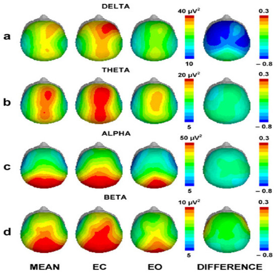 Electronics | Free Full-Text | Deep Learning Techniques for Pattern ...