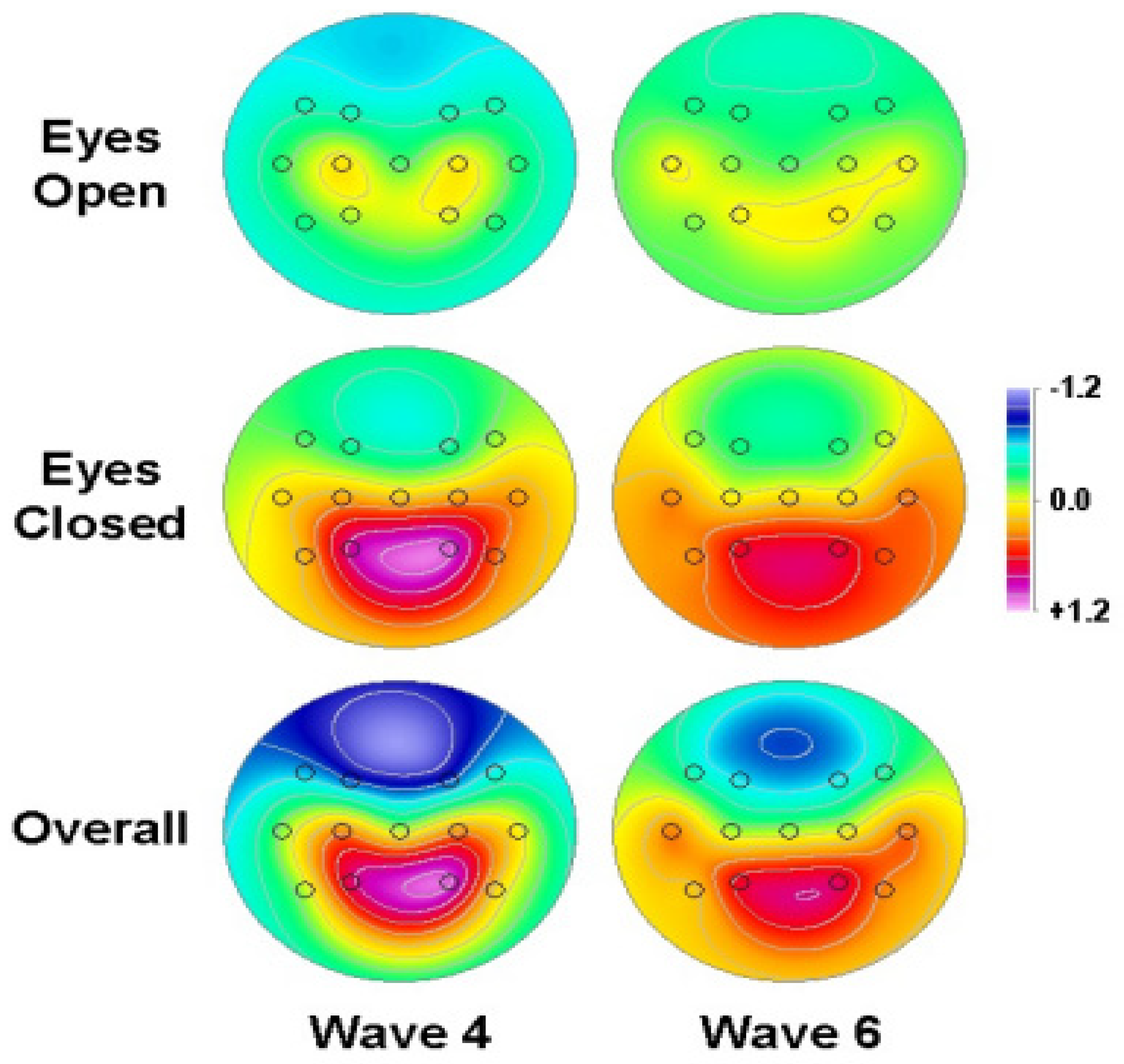 Electronics | Free Full-Text | Deep Learning Techniques for Pattern Recognition in EEG Audio ...