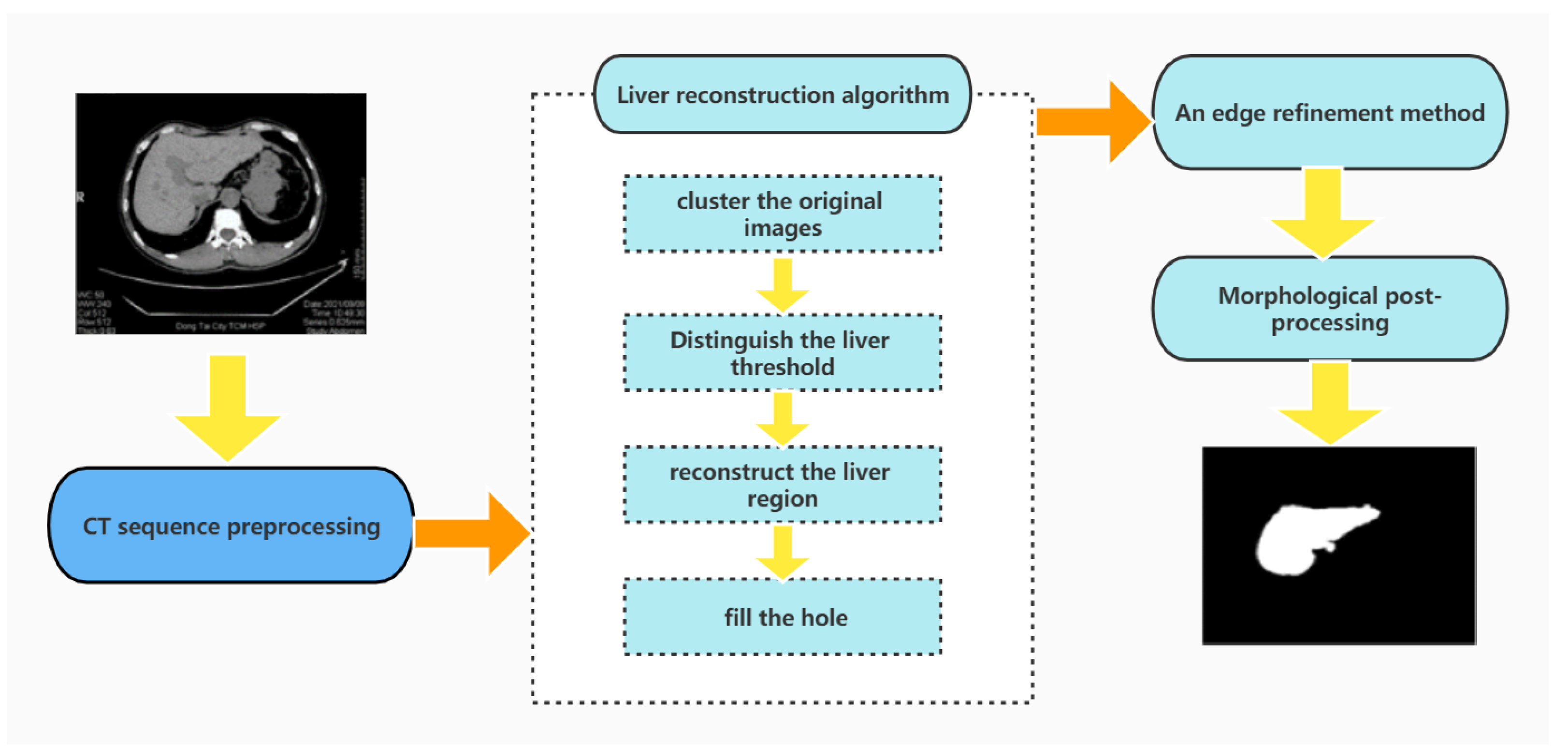 An Efficient Framework for Accurate Liver Segmentation in Abdominal CT ...