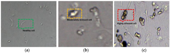 Computer Vision-Based Kidney’s (HK-2) Damaged Cells Classification with ...