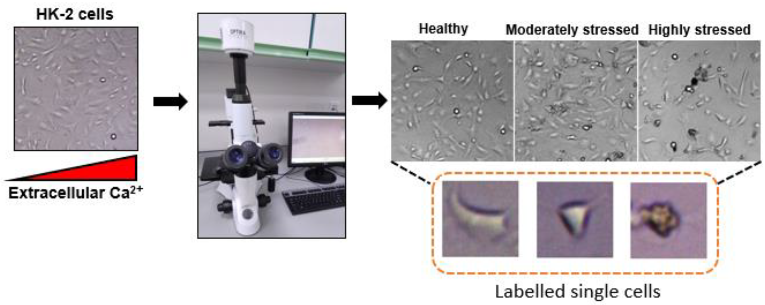 Computer Vision-Based Kidney’s (HK-2) Damaged Cells Classification with ...