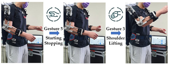 Electronics | Free Full-Text | A Novel Wearable Upper-Limb Rehabilitation Assistance Exoskeleton ...