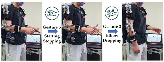 A Novel Wearable Upper-Limb Rehabilitation Assistance Exoskeleton ...