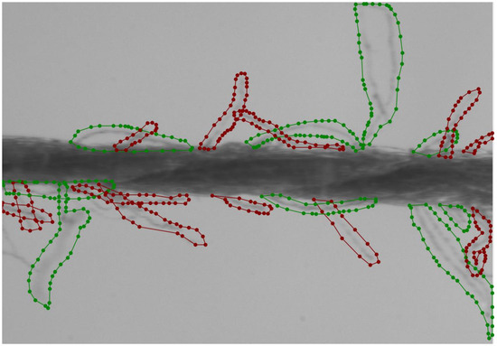 Intelligent Computer Vision System for Analysis and Characterization of ...