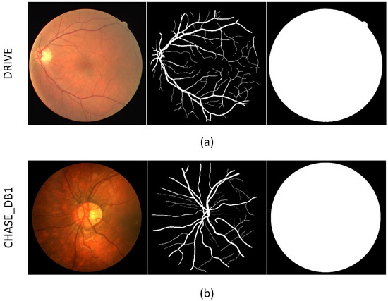 Improvement of Retinal Vessel Segmentation Method Based on U-Net