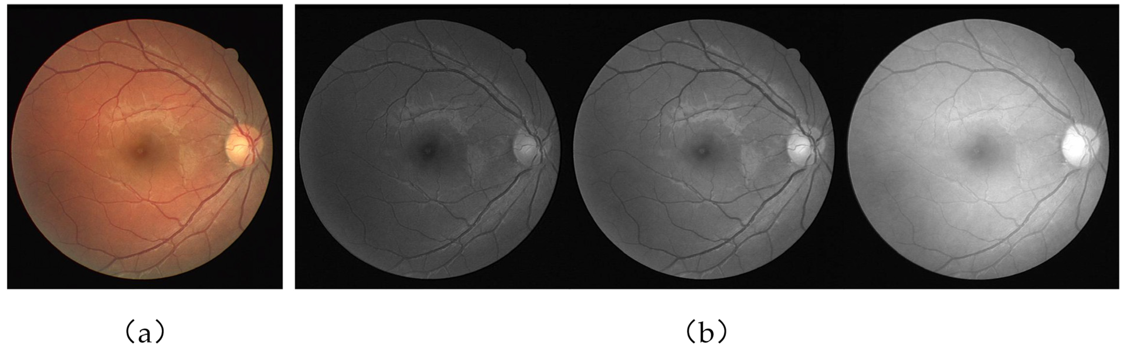 Improvement of Retinal Vessel Segmentation Method Based on U-Net