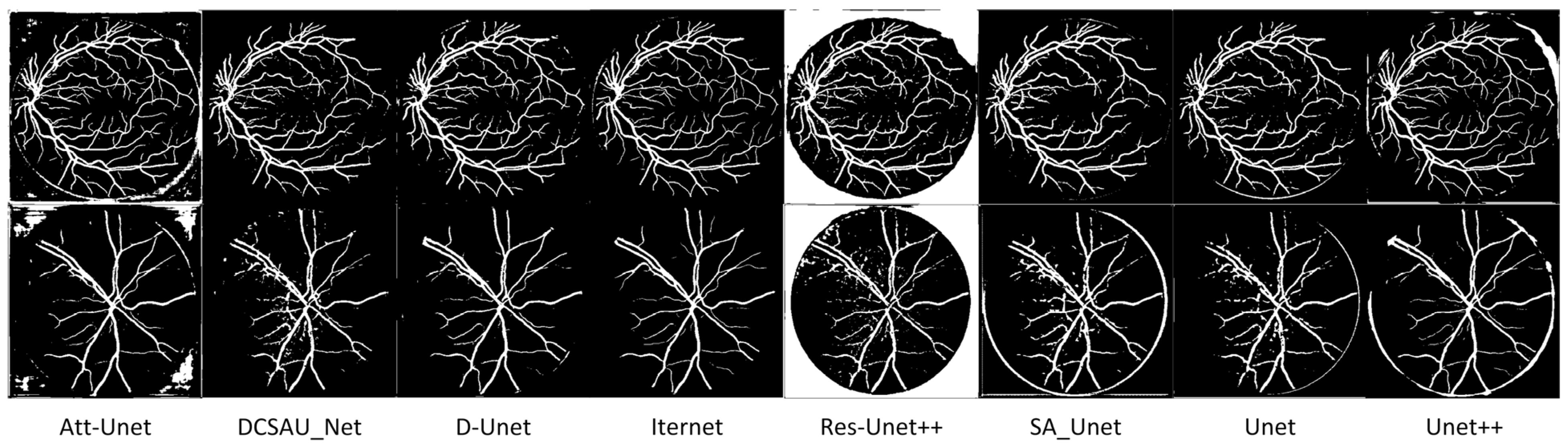 Improvement of Retinal Vessel Segmentation Method Based on U-Net