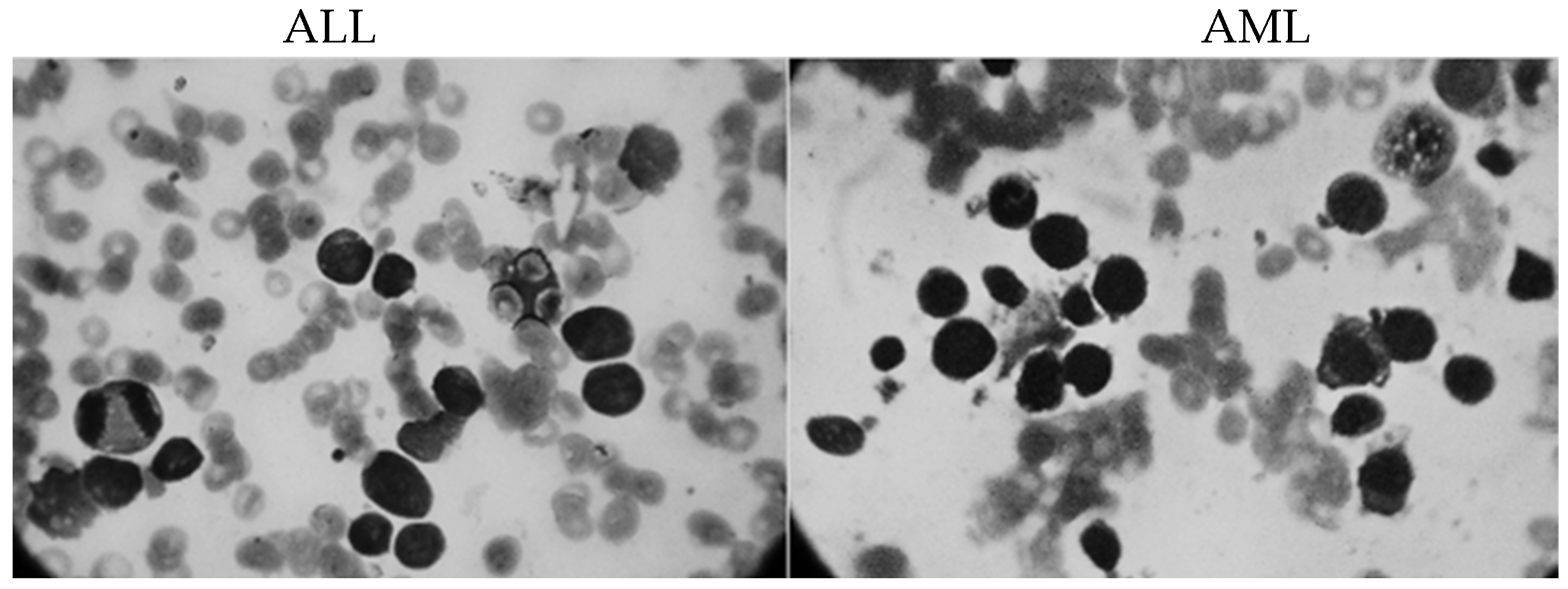 A Customized Efficient Deep Learning Model for the Diagnosis of Acute ...
