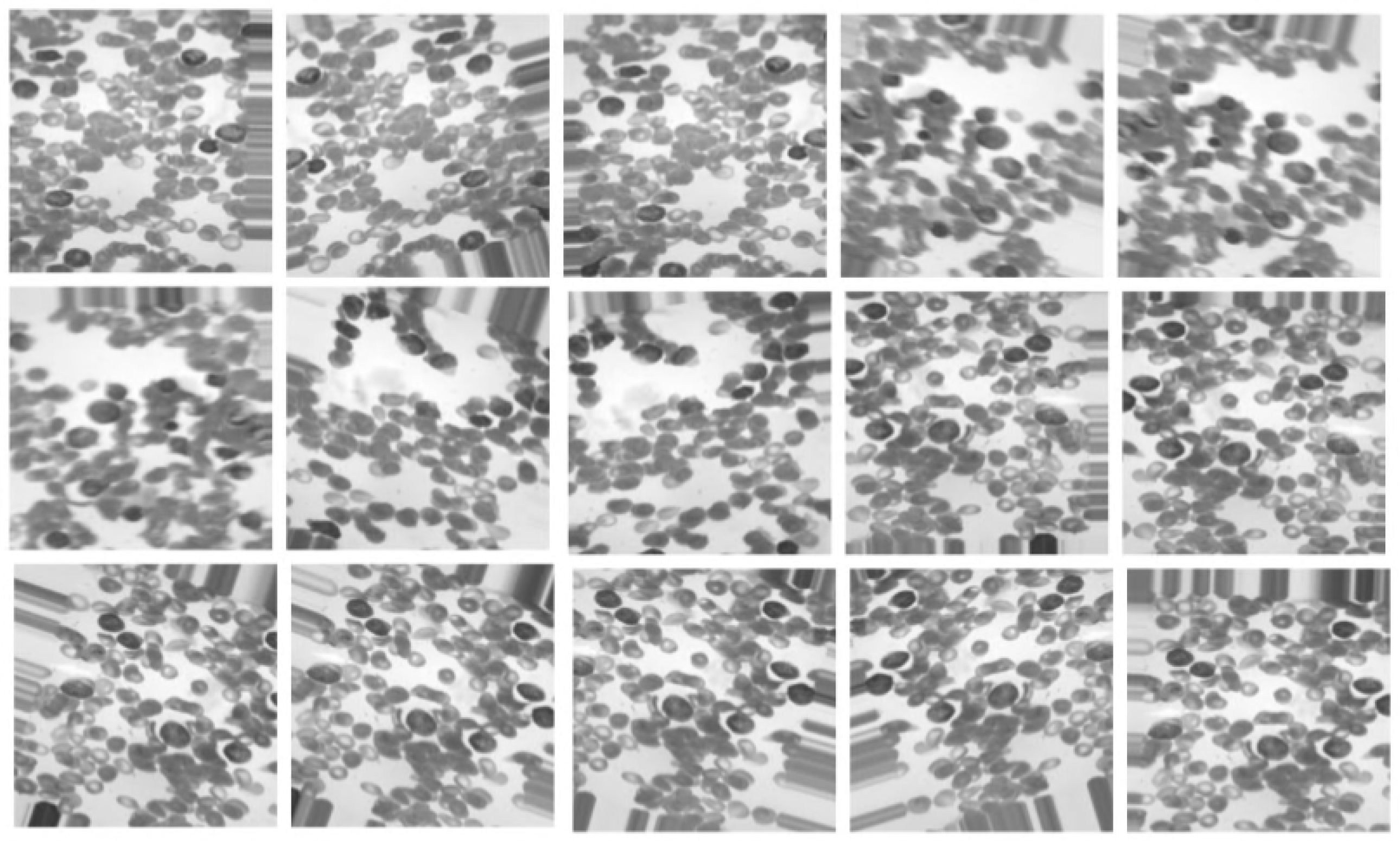 A Customized Efficient Deep Learning Model for the Diagnosis of Acute ...