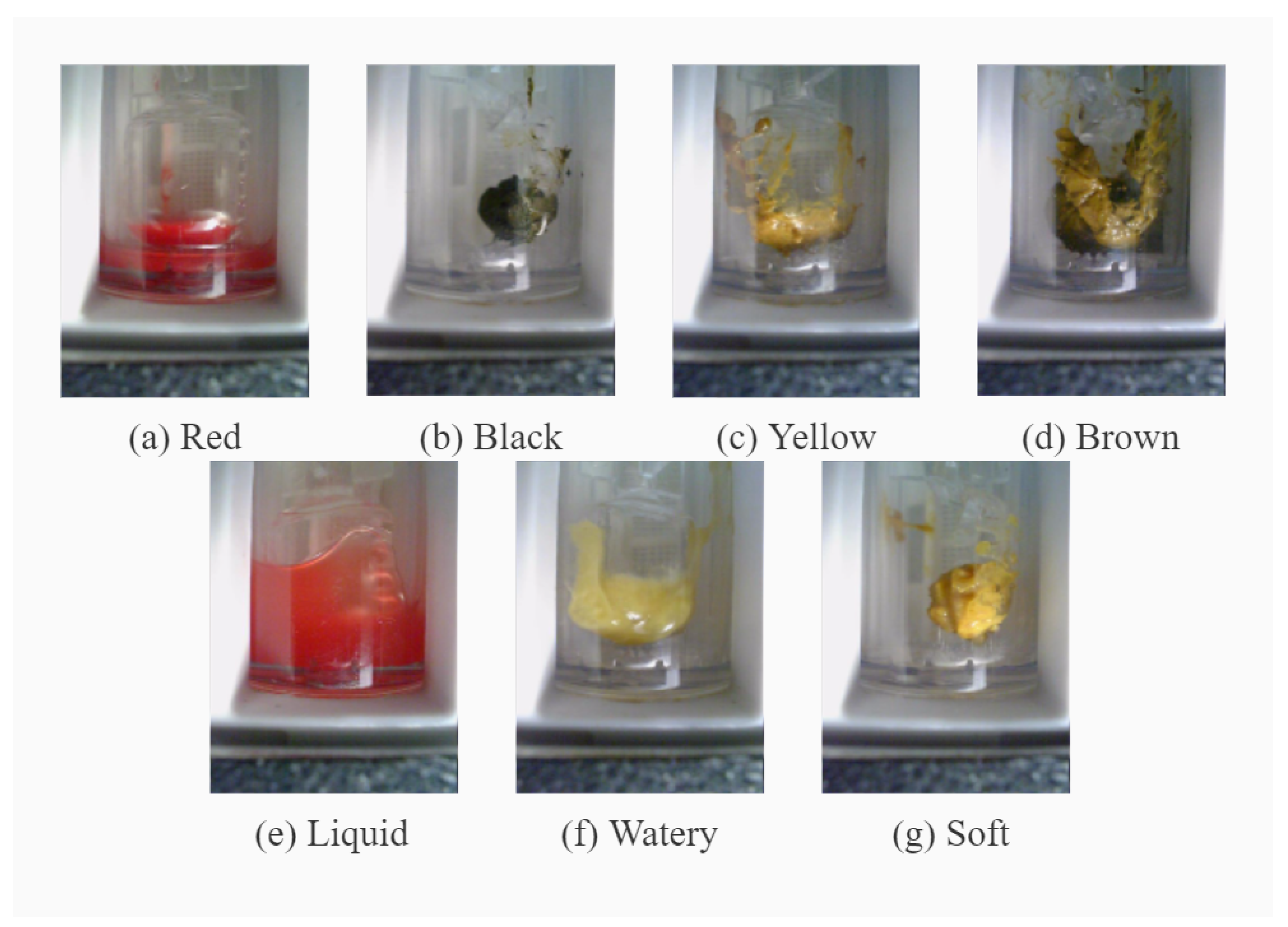 E-Health Self-Help Diagnosis from Feces Images in Real Scenes